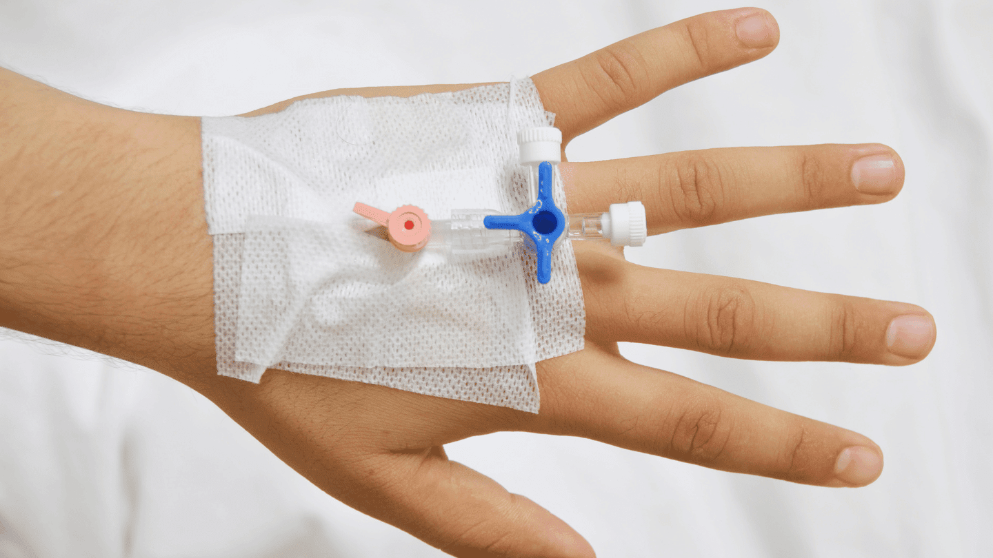 Venous Stasis: Definition, Causes, Symptoms, Treatment | QuickMD